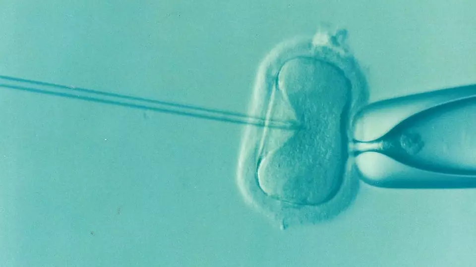 IVF बाळं त्यांच्या समवयस्कांइतकीच हुशार असतात, अभ्यास सुचवतो